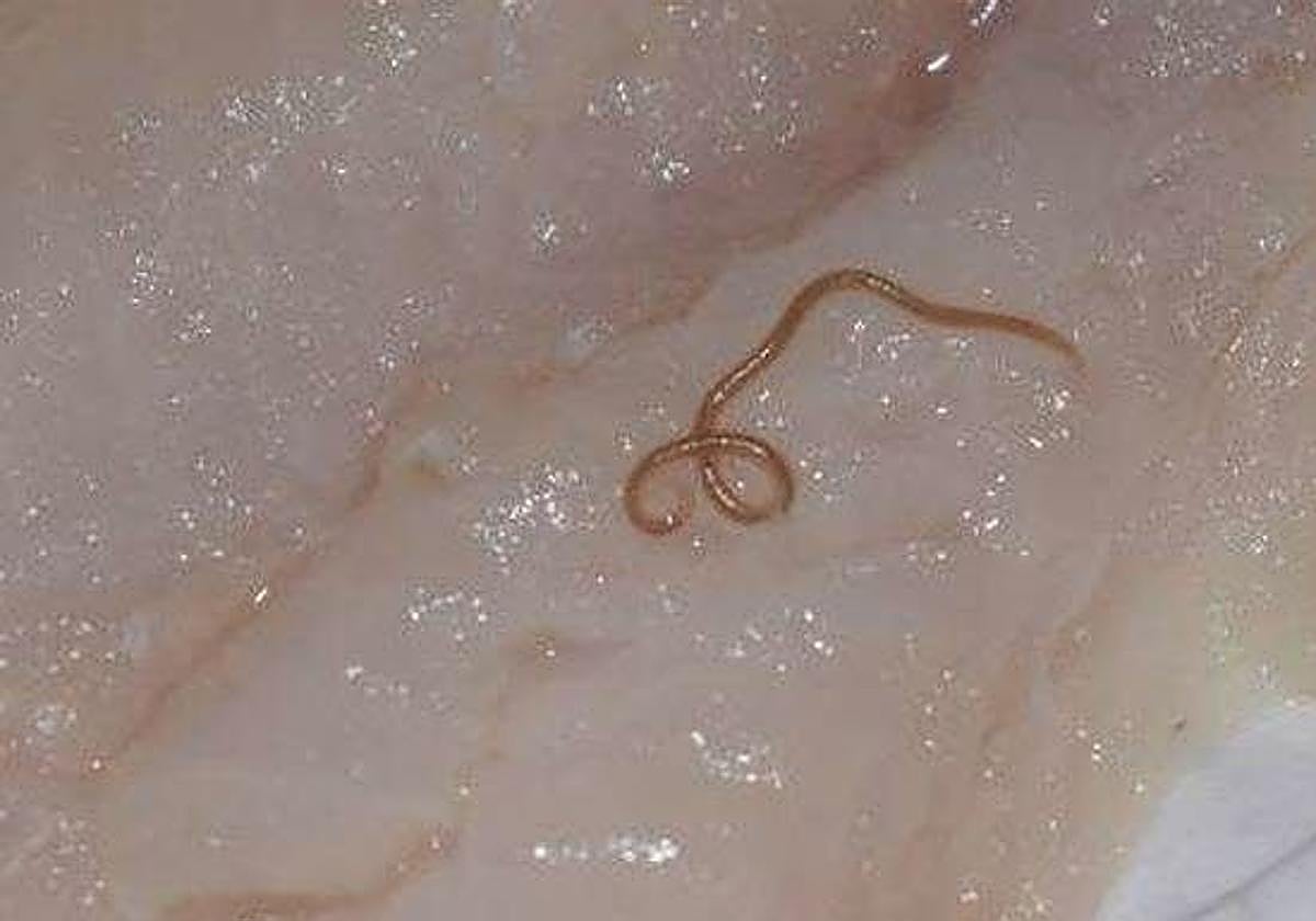 La OCU pide «precaución» por la alerta sanitaria grave sobre los anisakis pero dice que «no hay ...